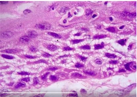 Integument Flashcards Quizlet