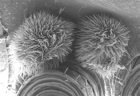 External Anatomy Of Polydesmida Spiracles