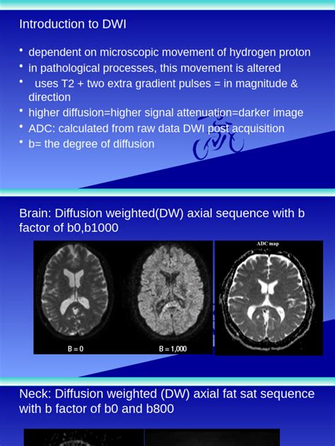 Introduction To Diffusion Weighted Imaging Pdf