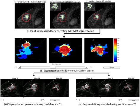 Workflow Diagram I Inputs Used For Generating Segmentations Ii