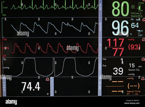 Vital Signs Monitor