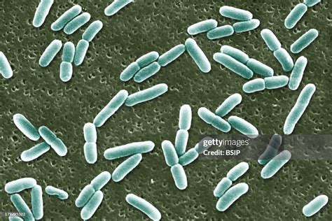 Escherichia Coli Sem Scan Electron Micrography News Photo Getty Images