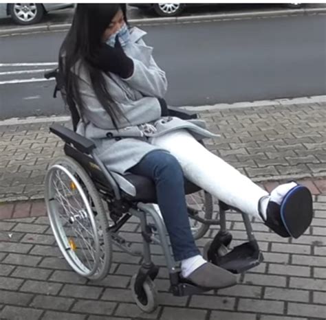 My Plaster Long Leg Cast Llc Network For Casters