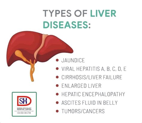 Liver Disease Dorens Specialist Hospital