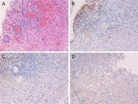 Siglec15 Polyclonal Antibody Pa5 72765