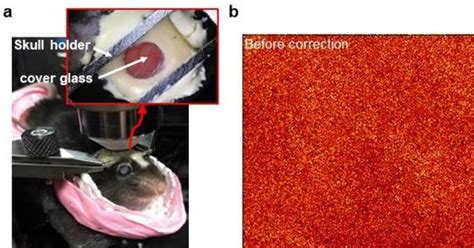 두개골 훼손 없이 뇌 신경망 구조 고해상도로 본다