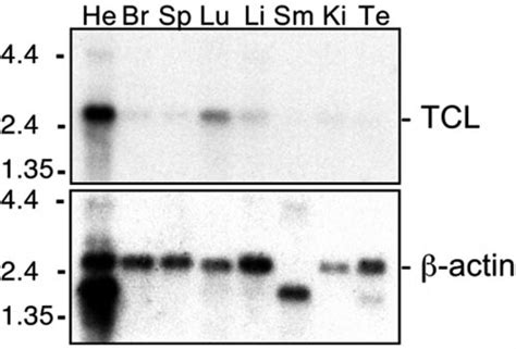 Schematic Representation Of Human Tcl Gene Structure Tcl Exons Iv Download Scientific