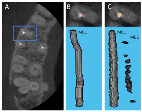 Artificial Intelligence Ai For Detection And Localization Of