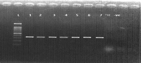 Pcr Based Detection Of T Gondii Dna In Brain Samples Of Rodents From Download Scientific
