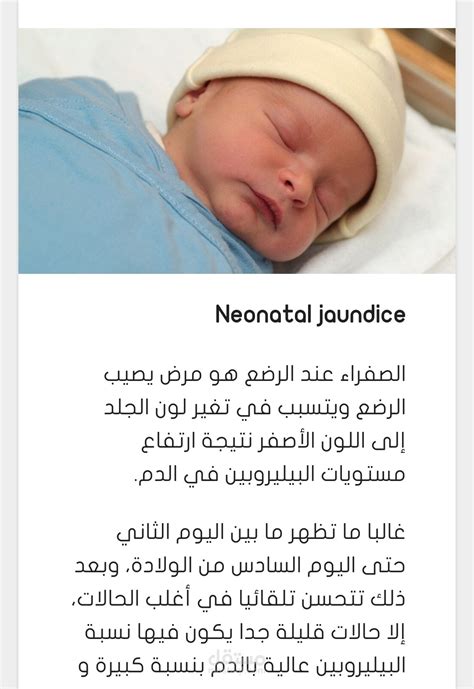 الصفراء عند الرضع مستقل