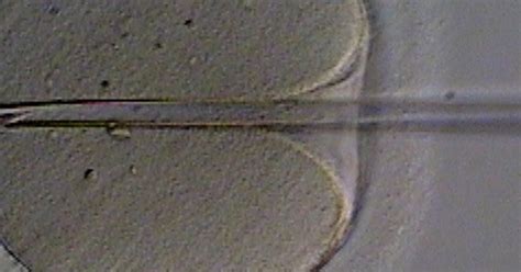Ivg Is The New Reproductive Technology For Same Sex Procreation Ivg Is The New Reproductive Technology For Same Sex Procreation