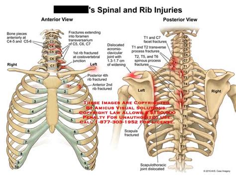 Medical Exhibits Demonstrative Aids Illustrations And Models