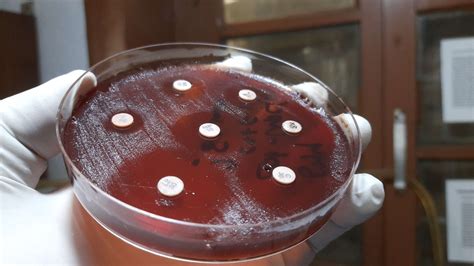 Antibiotics Sensitivity Testing Ast Pattern Of Enterococcus