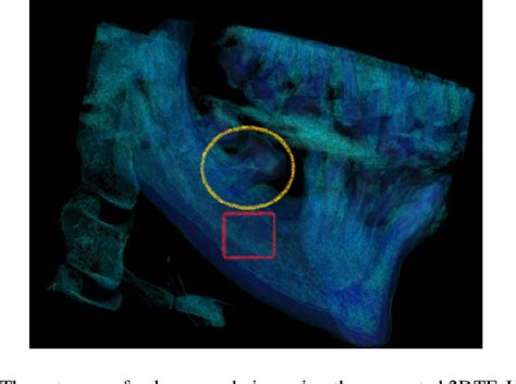 Figure 2 From Interactive Volume Rendering Module Using Two Dimensional Transfer Function On