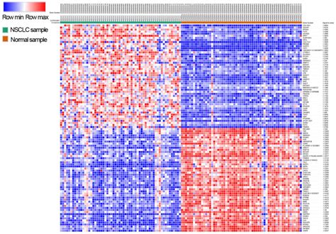 Identification Of Potential Diagnostic And Prognostic Biomarkers In Non Small Cell Lung Cancer