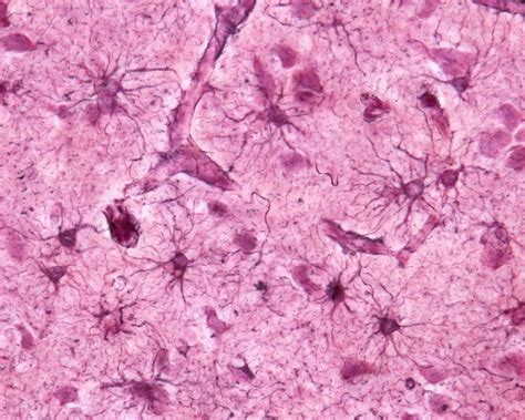 Astrocytes Light Micrograph Stock Image C048 2994 Science Photo Library