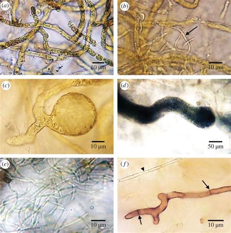 Light Microscope Photographs Of The Endolithic Community From The Green Download Scientific