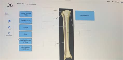 Solved Help Save And Exit Sub Label The Bony Structures 36 02