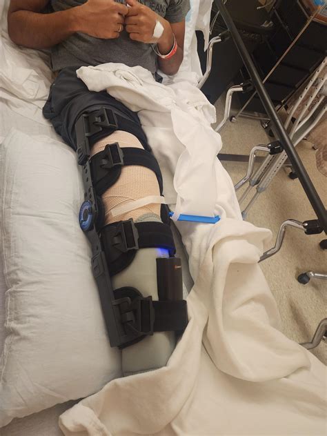Just Had Aclr With Hamstring Autograft Along With Meniscus Repair R Acl