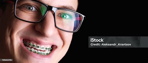 비뚤어진된 하얀 치아와 검은 배경 복사 공간에 금속 브래킷 클로즈업과 남자의 초상화 치과 교정 중괄호와 젊은 남자 치과 약 맞춤 치아 치열 교정의 건강관리와 의술에 대한