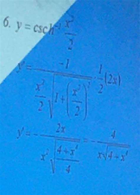 [hyperbolic Derivative] Can Someone Explain How Was This Solved R