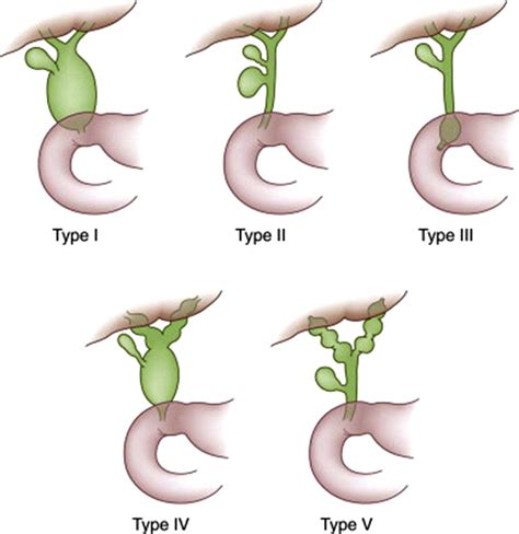 Anatomy And Embryology Of The Biliary Tract Surgical Clinics