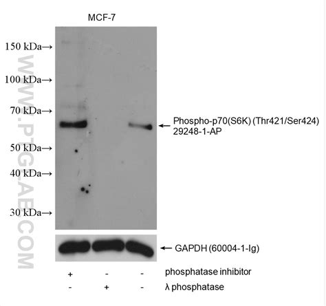 Phospho P70s6k Thr421ser424 Antibody 29248 1 Pbs Proteintech