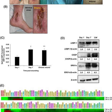 The Endoplasmic Reticulum Er Is Dilated In Keratinocytes Adjacent To