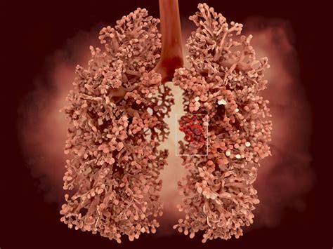 Experts Ring The Alarm Over Popcorn Lung Caused By Vaping — Details