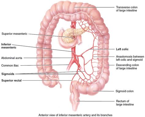 Mesenteric Ischemia Causes Symptoms Diagnosis Treatment And Prognosis