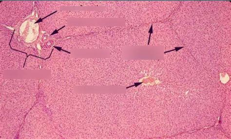 Liver Histology Diagram Quizlet
