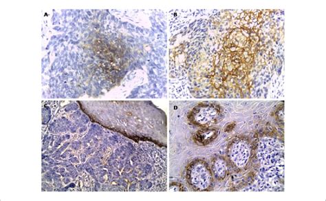 Cytoplasmic A And Membranous B Localization Of GLUT Mainly In The Download Scientific