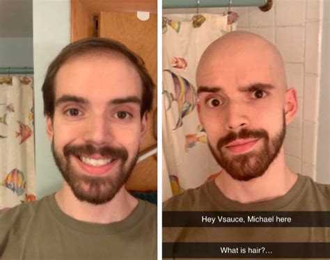 Finally R Asmongold