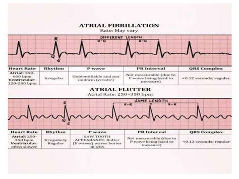 Atrial Fib And Atrial Flutter Pptx