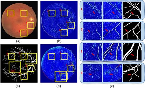 Feature Maps After The First Convolution In The First Level Of The Download Scientific Diagram