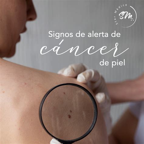 El Abcde Es Un Esquema De Star Médico Consultorios