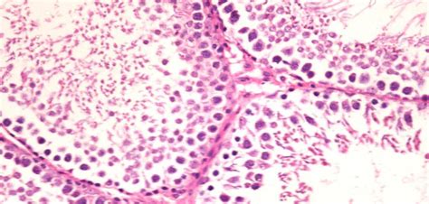 Section In The Testicular Tissue Of Control Group After 12 Weeks Show