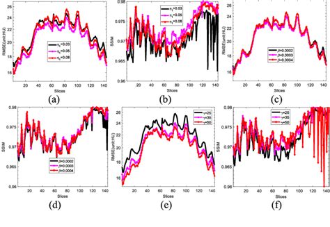 Figure 12 From Tensor Gradient L₀ Norm Minimization Based Low Dose Ct And Its Application To