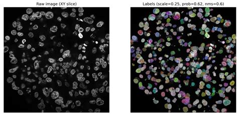 Using Stardist 3d Demo Model For Embryo Nucleus Segmentation Questions On Scaling Anisotropy