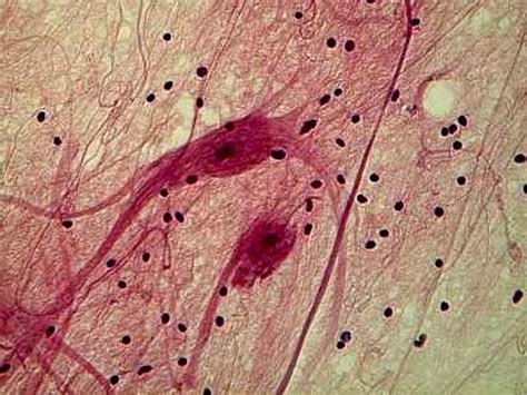 Nerve Cell Light Microscope