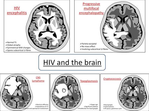 Practice Questions For The Frcr Part 2a Medical Exam Prep