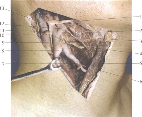 图19 353 颈外动脉 口腔颌面及颈部临床解剖学 医学