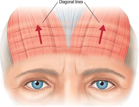 Blepharoplasty Clinical Tree