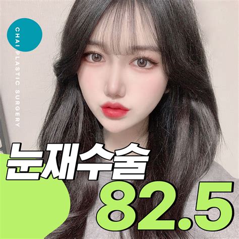 차이성형외과 강남언니 1등 성형수술and피부시술 정보앱