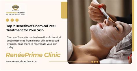 Top 7 Benefits Of Chemical Peel Treatment For Your Skin