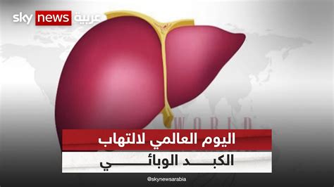 اليوم العالمي لالتهاب الكبد الوبائي جهود دولية لمكافحة المرض Youtube