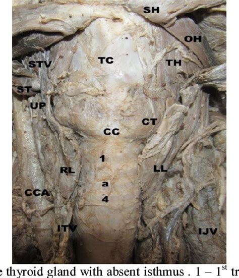 Thyrohyoid Cadaver