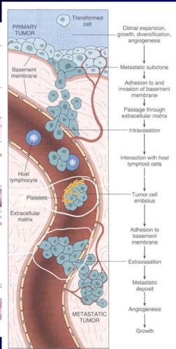 Metastasis Flashcards Quizlet