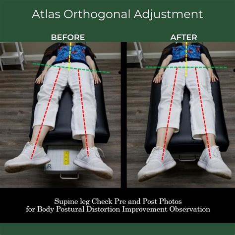 Self Adjusting Neck Vertebrae At Margaret Steen Blog