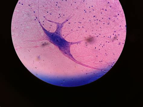 Nervous Tissue 400x Nervous Tissue 400x